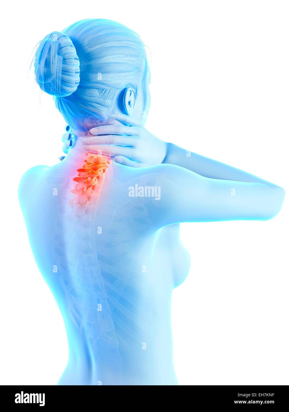 Human neck pain, illustration Stock Photo - Alamy