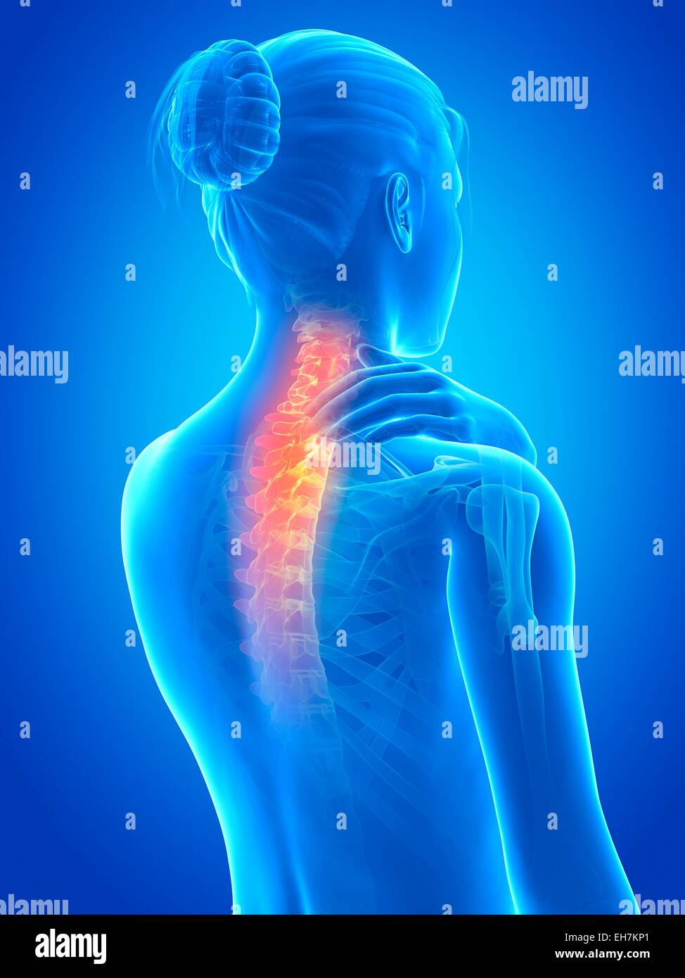Human neck pain, illustration Stock Photo - Alamy