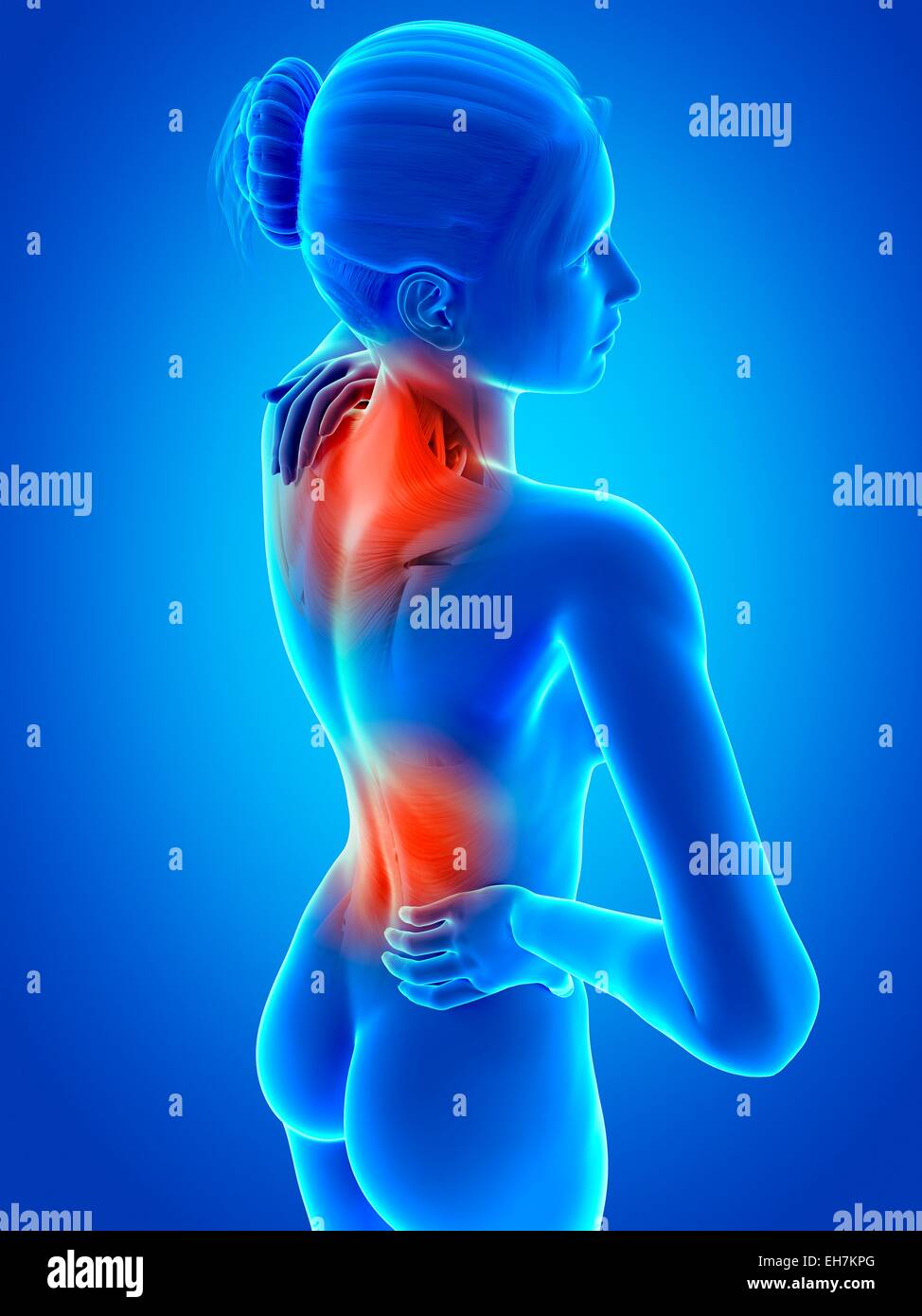 Human back pain, illustration Stock Photo - Alamy
