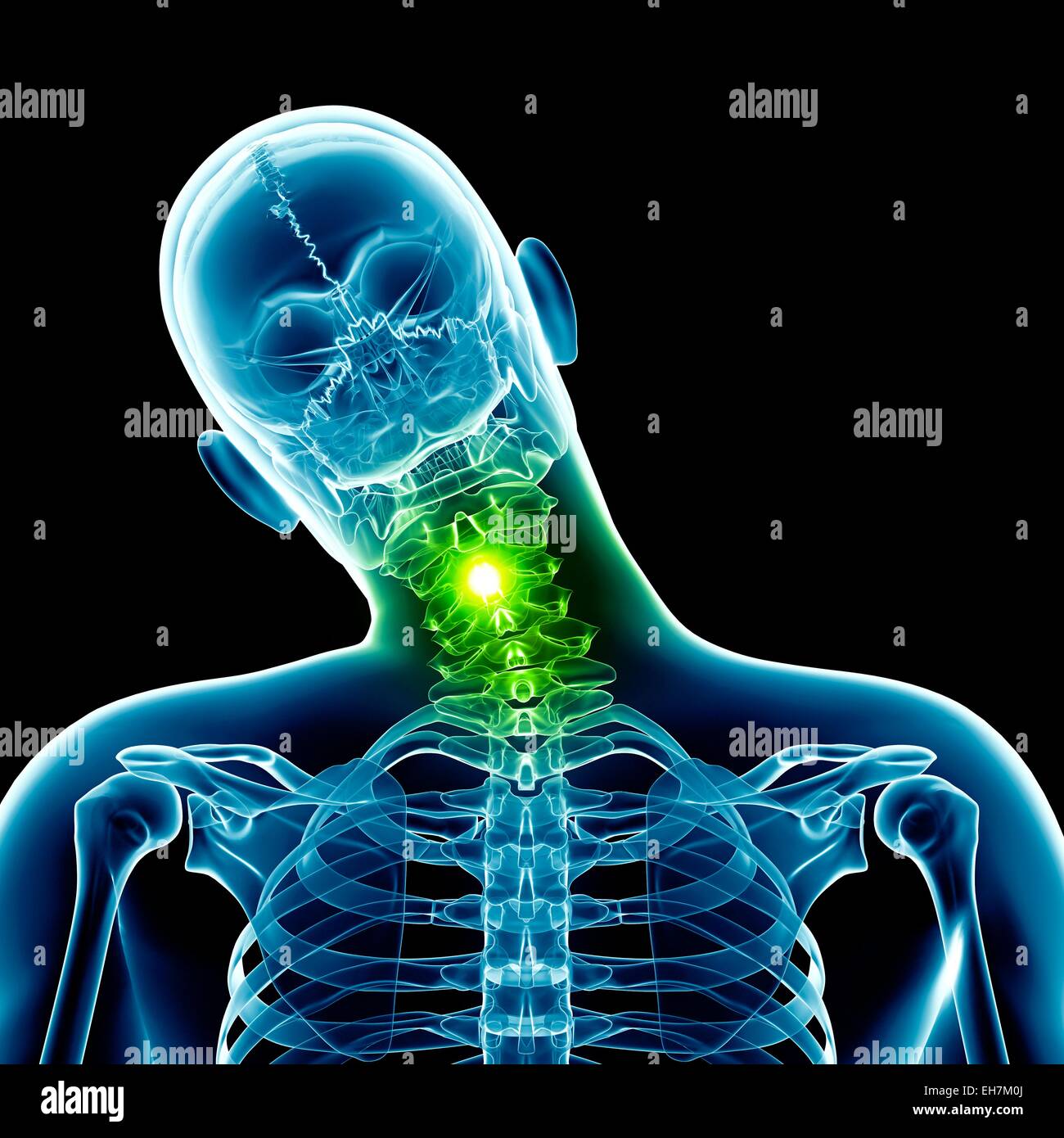 Human neck bones, illustration Stock Photo - Alamy
