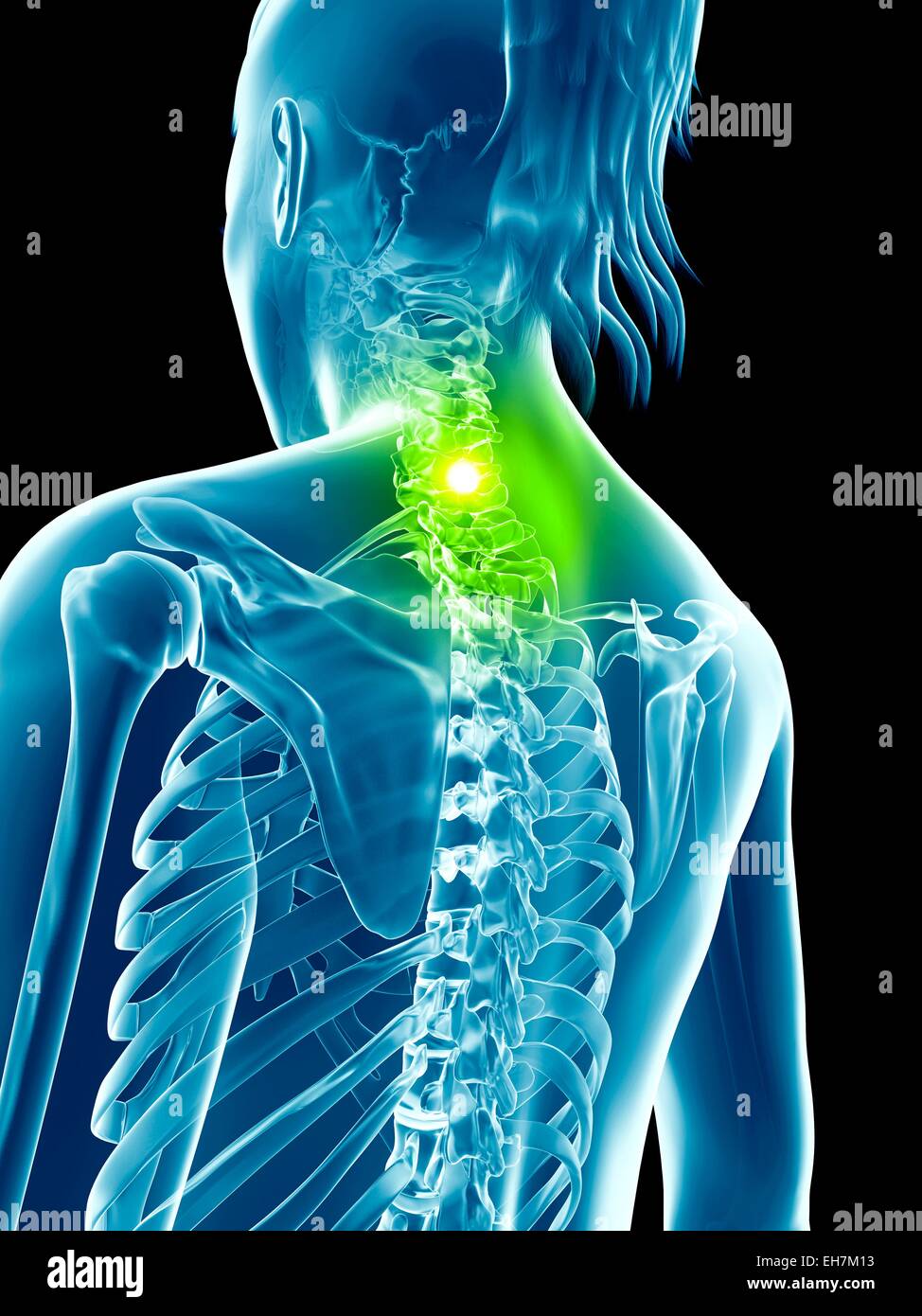 Human neck bones, illustration Stock Photo - Alamy