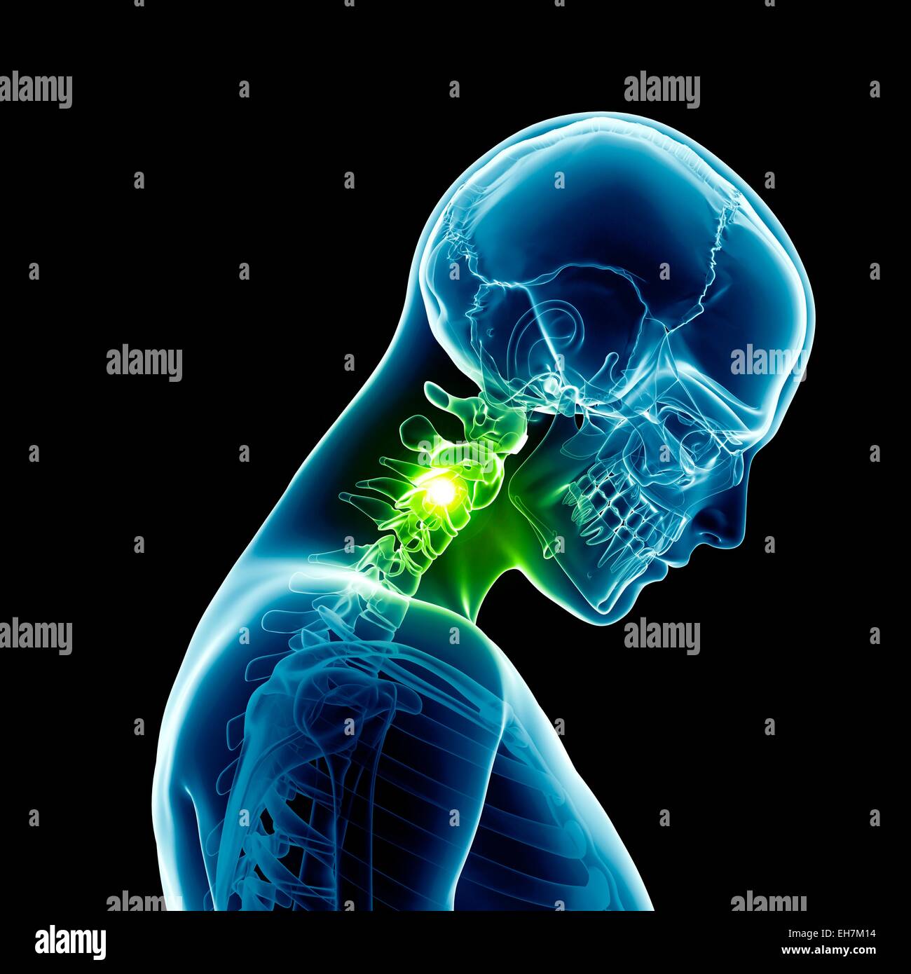 Side view bones head neck hi-res stock photography and images - Alamy
