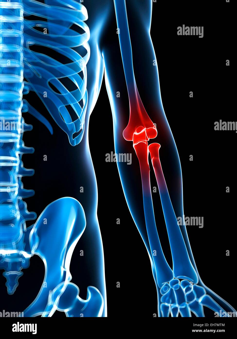 Human elbow pain, illustration Stock Photo - Alamy