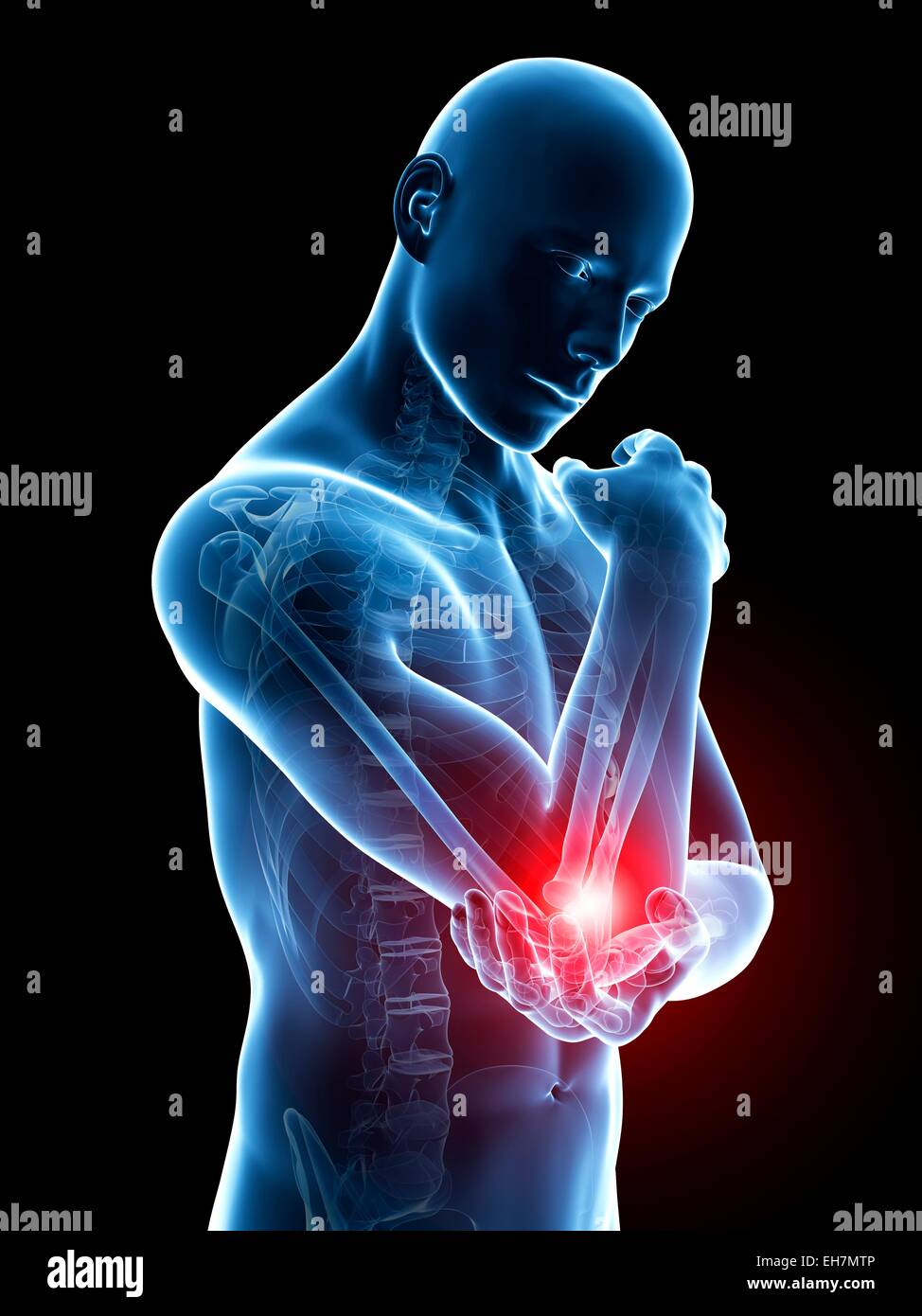 Human elbow pain, illustration Stock Photo - Alamy