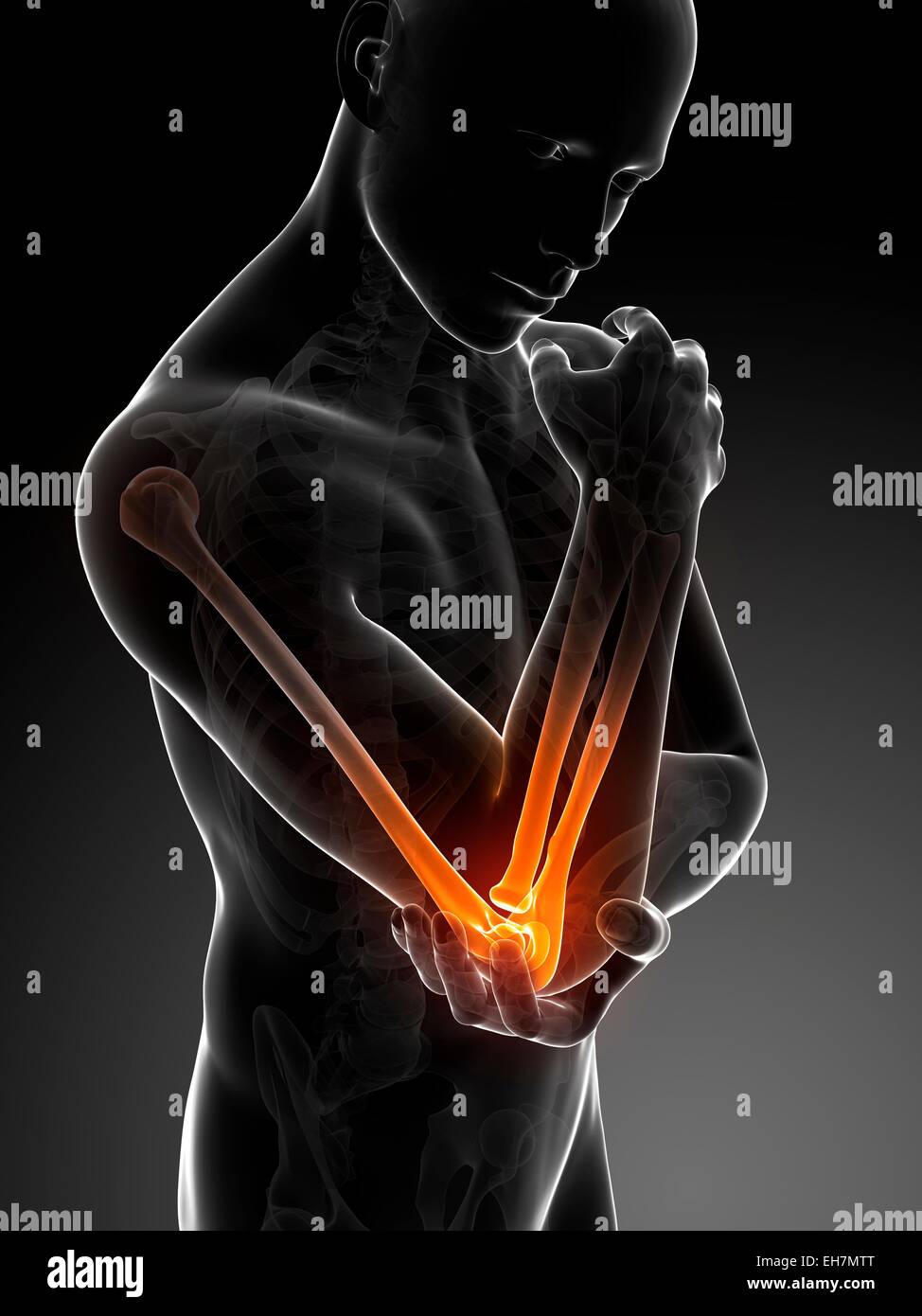 Human elbow pain hi-res stock photography and images - Alamy