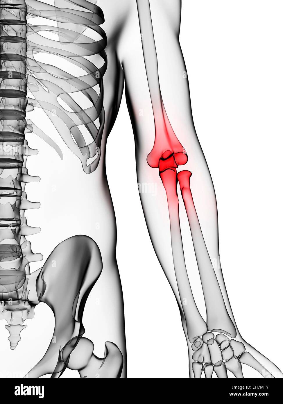 Human elbow pain, illustration Stock Photo - Alamy