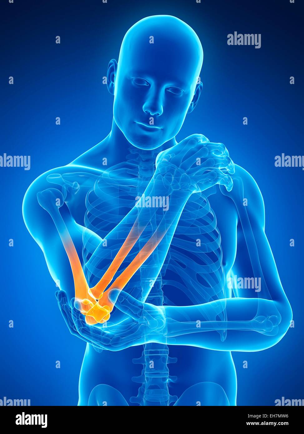 Human elbow pain, illustration Stock Photo - Alamy