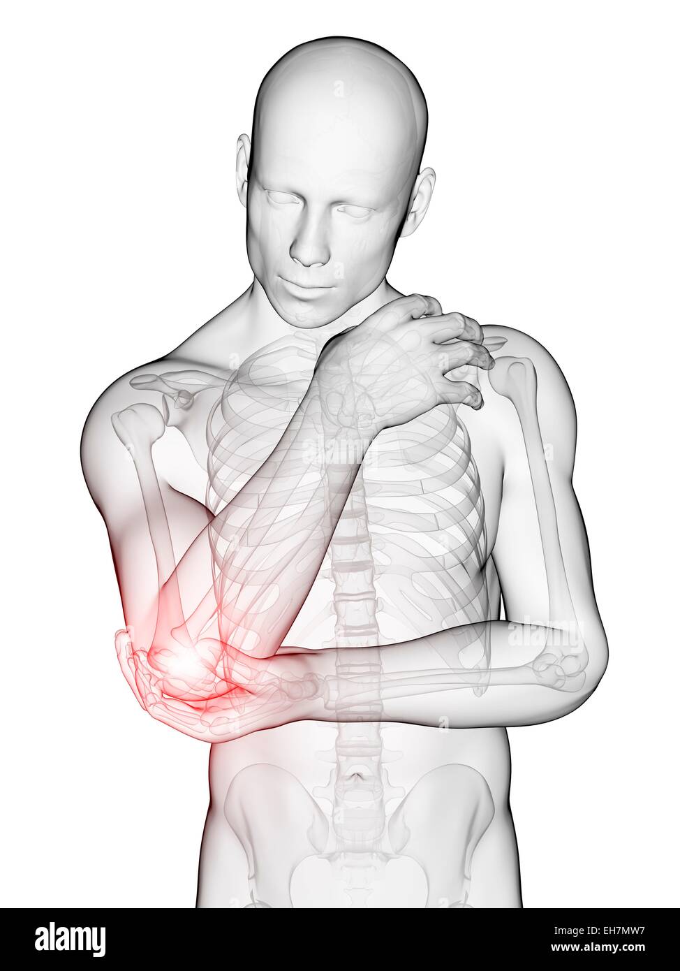 Human elbow pain, illustration Stock Photo - Alamy
