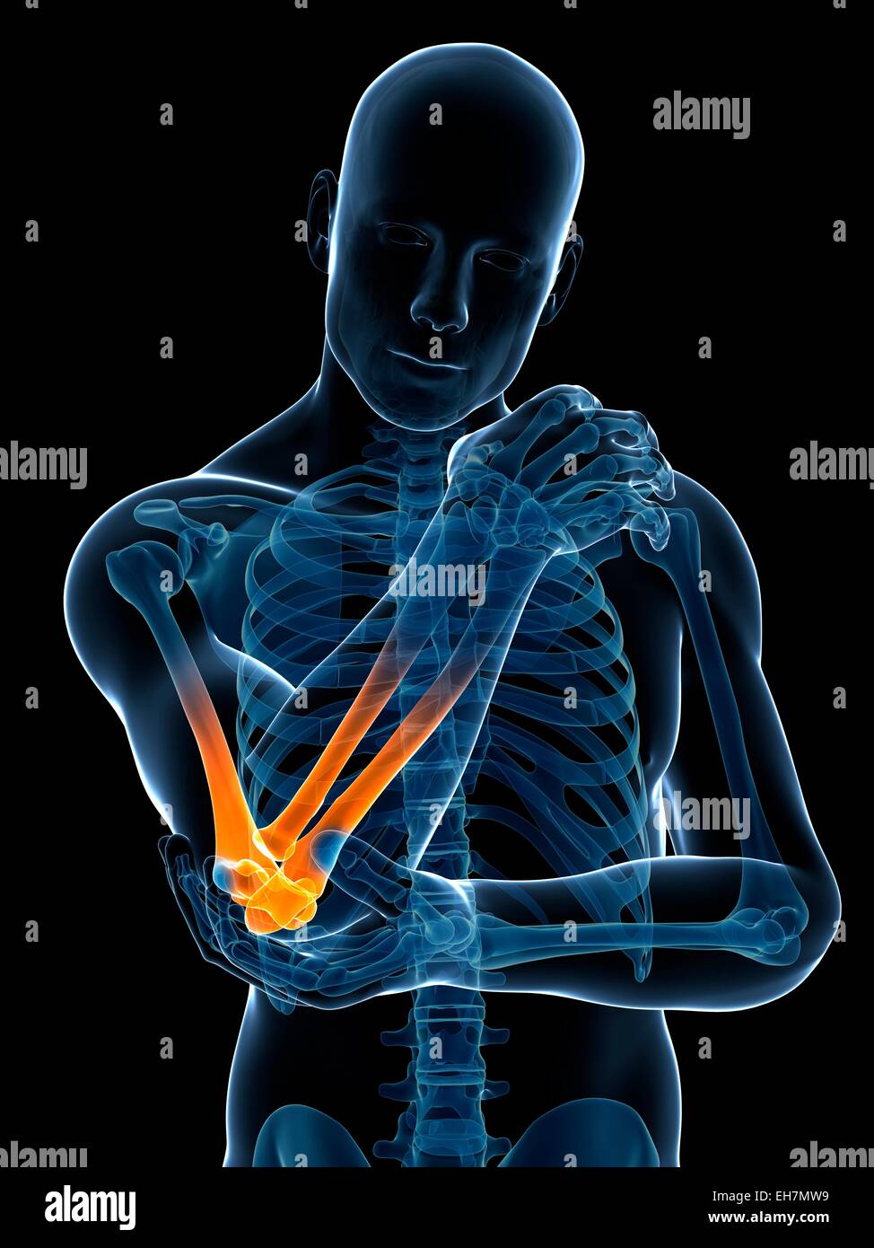 Human elbow pain, illustration Stock Photo - Alamy