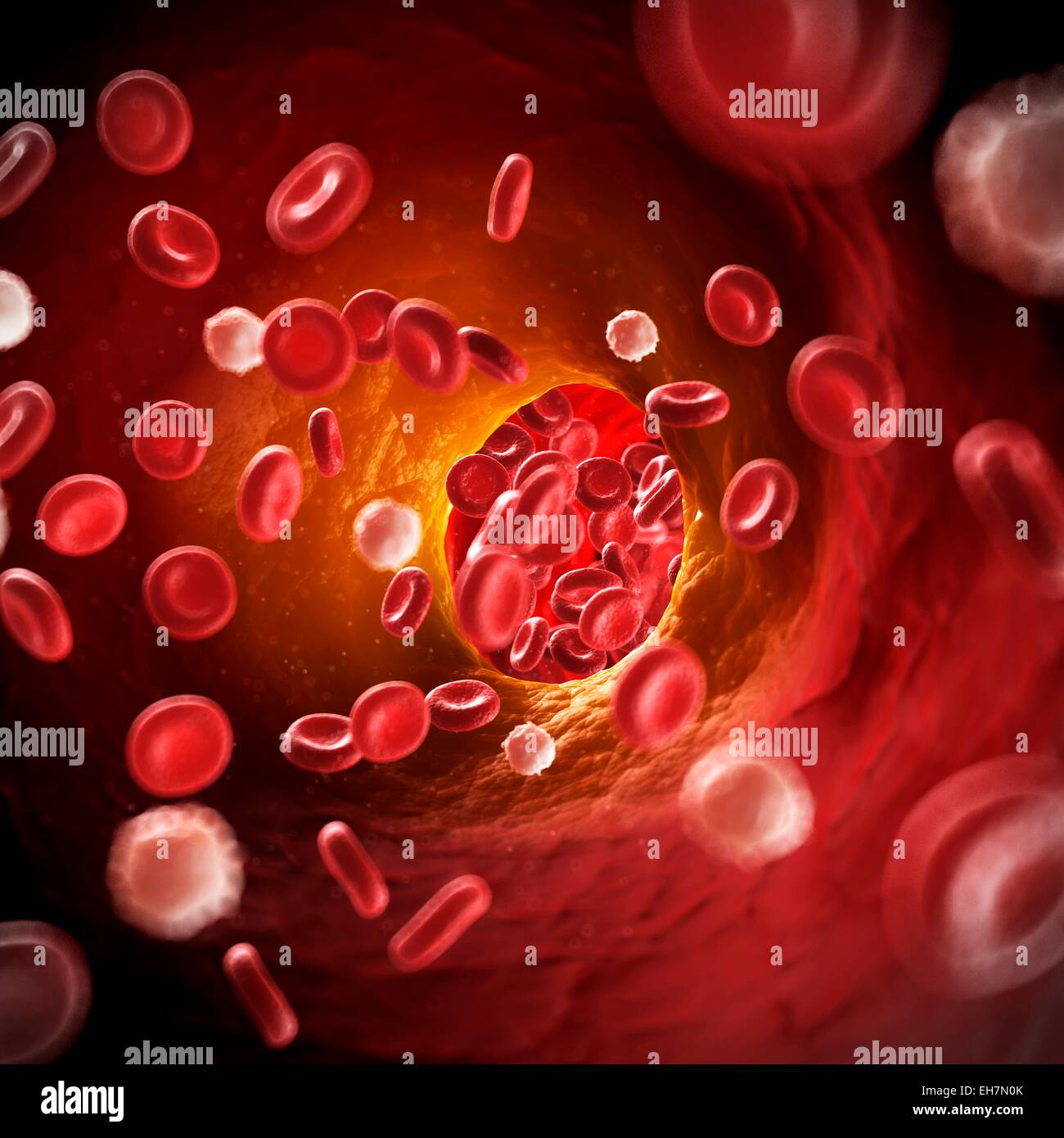 Arteriosclerosis illustration hi-res stock photography and images - Alamy