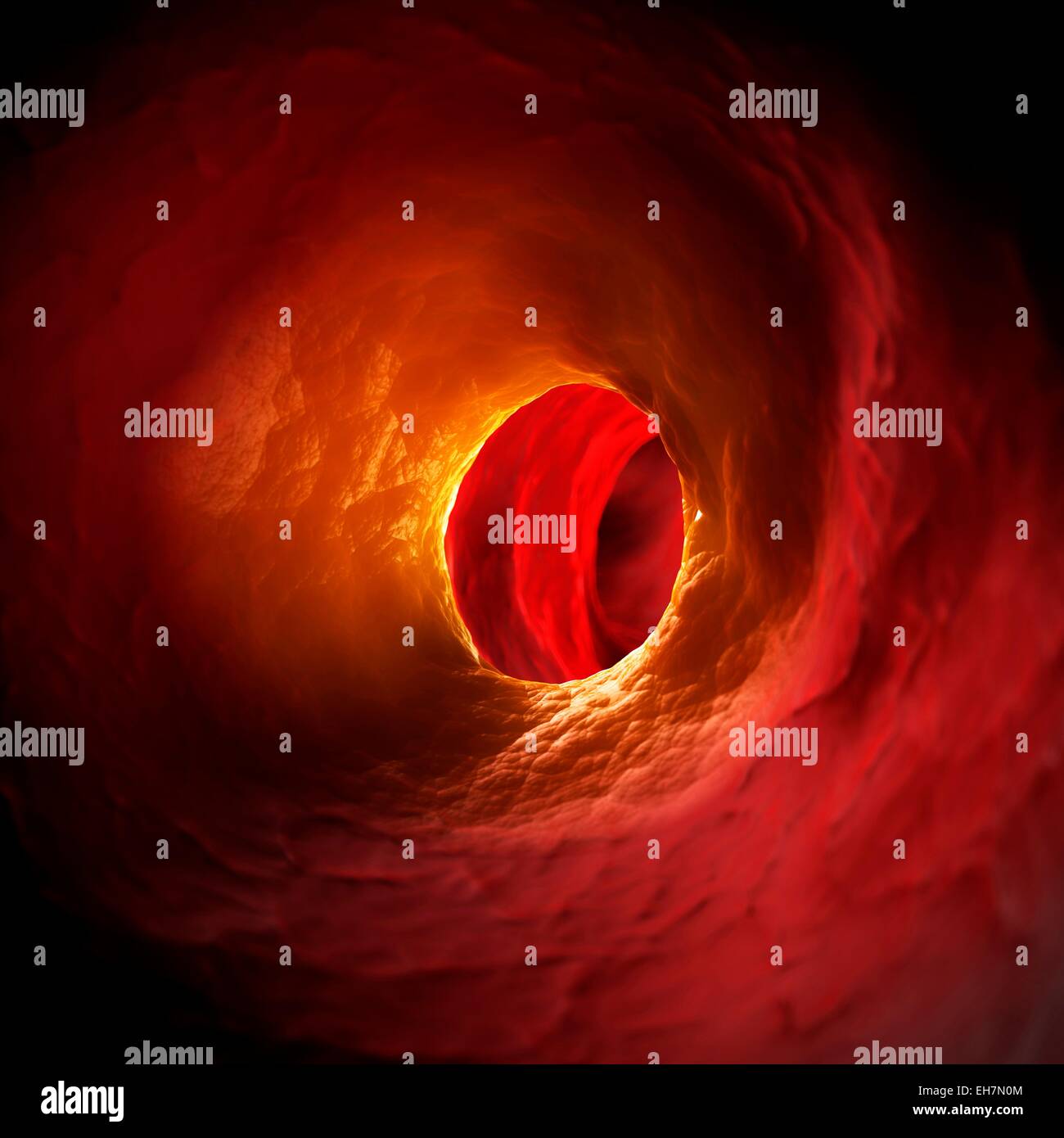 Arteriosclerosis hi-res stock photography and images - Alamy