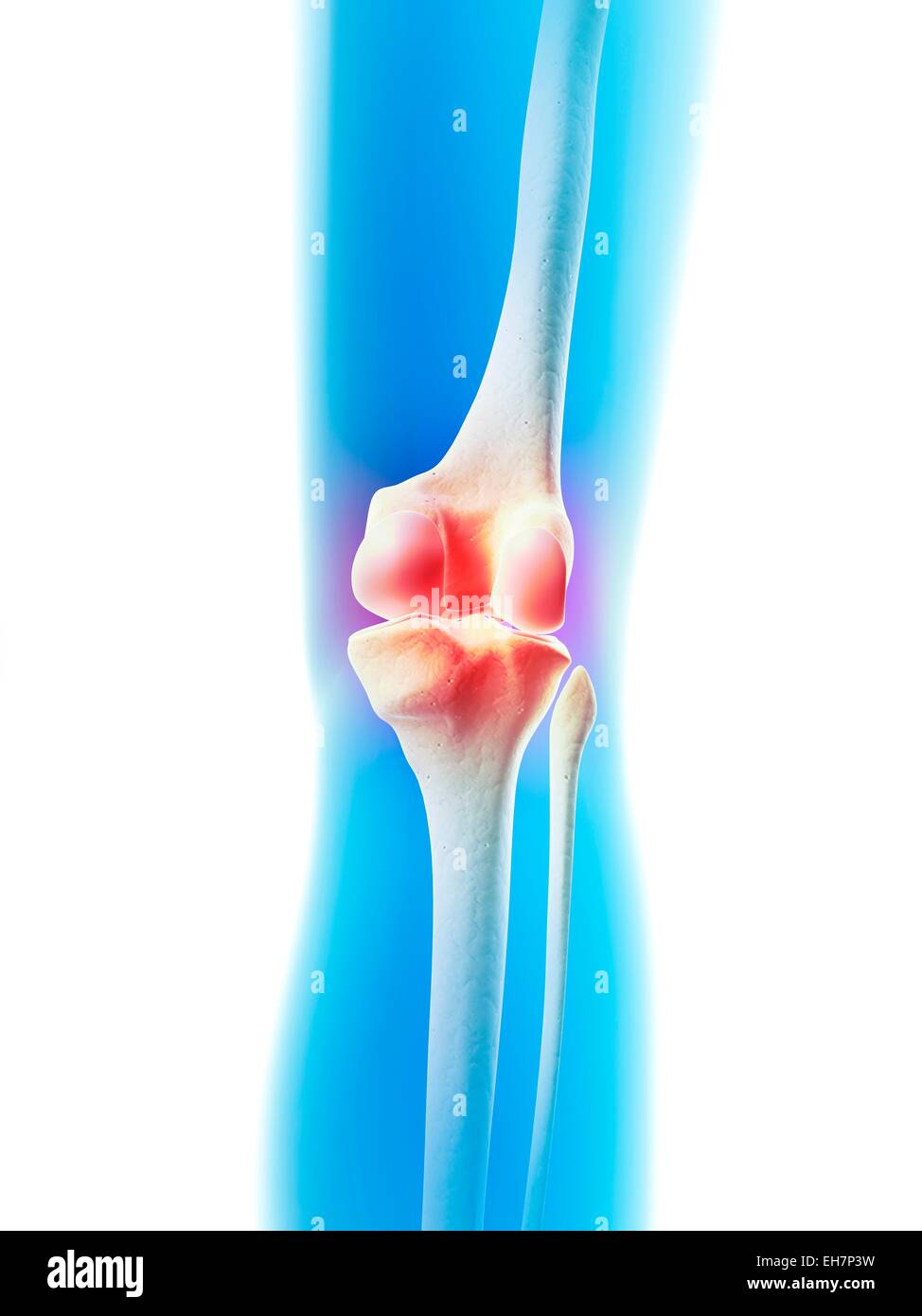 Human knee joint, illustration Stock Photo - Alamy