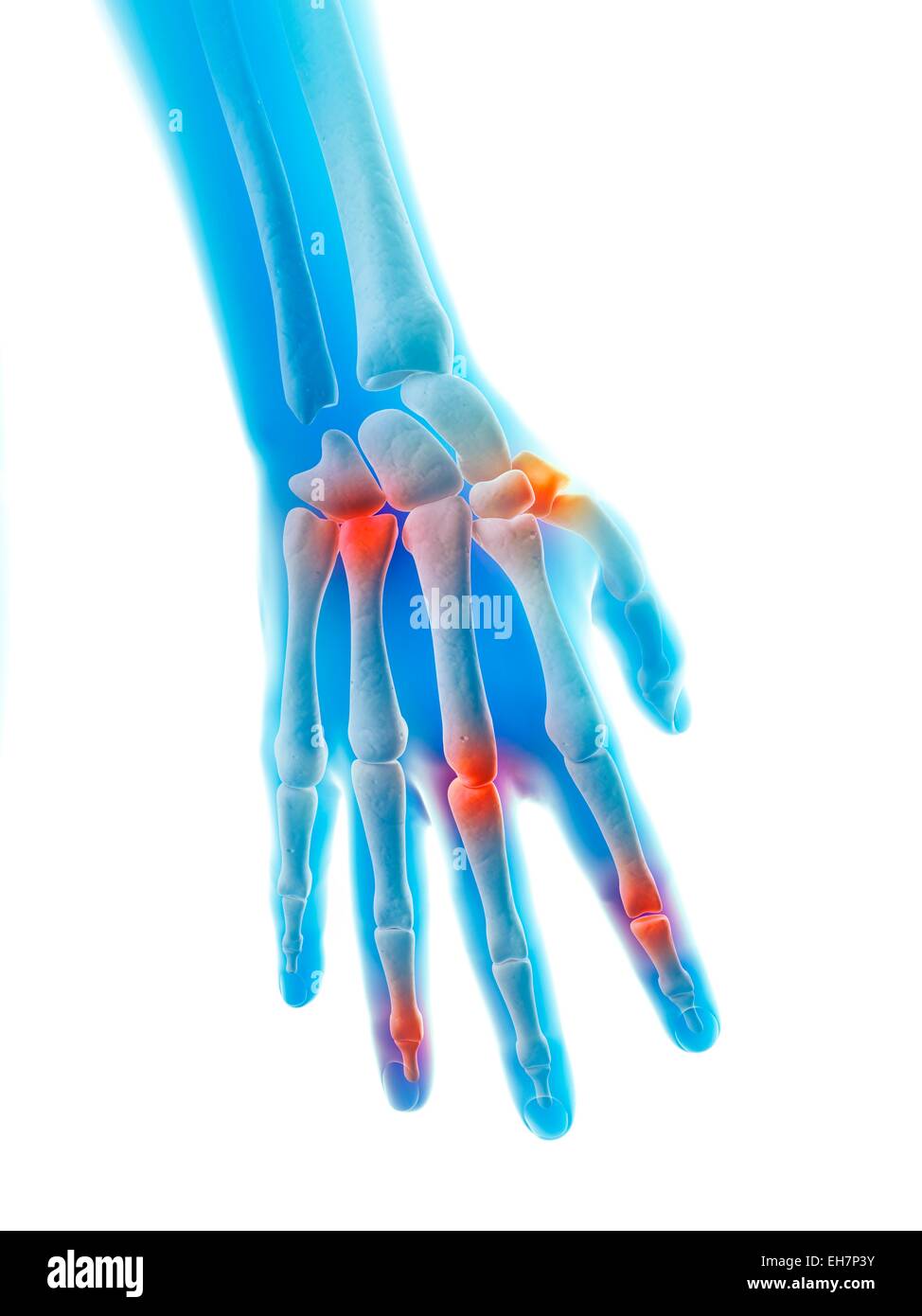 Hand Joints Illustration High Resolution Stock Photography and Images ...
