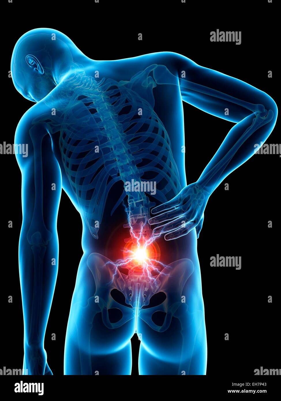 Human back pain, illustration Stock Photo - Alamy