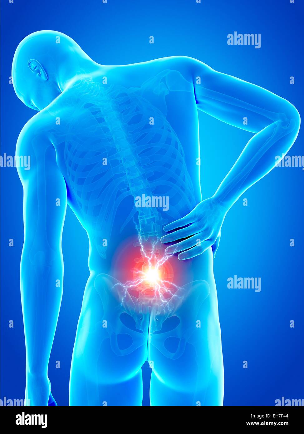 Human back pain, illustration Stock Photo - Alamy