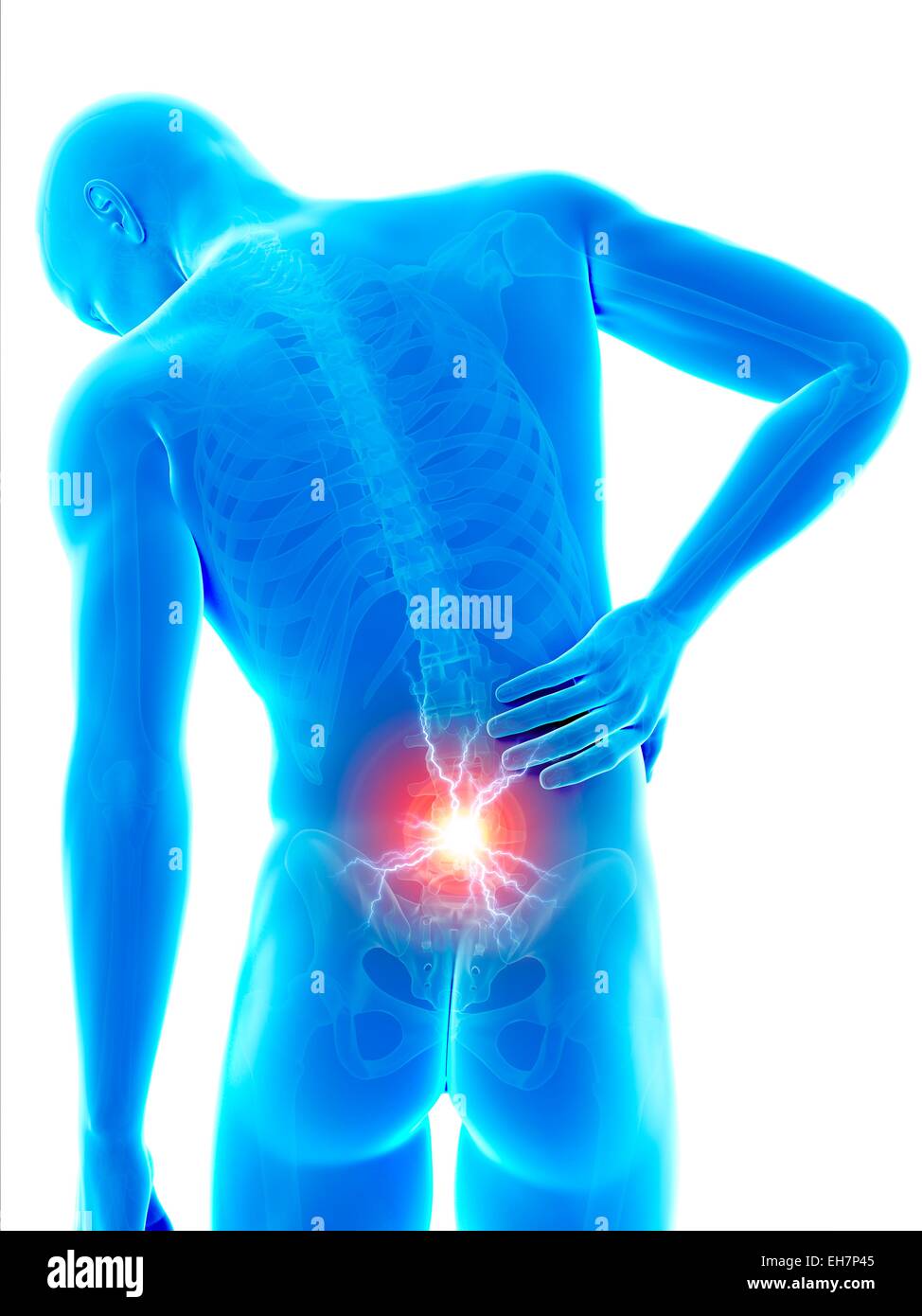 Human back pain, illustration Stock Photo - Alamy