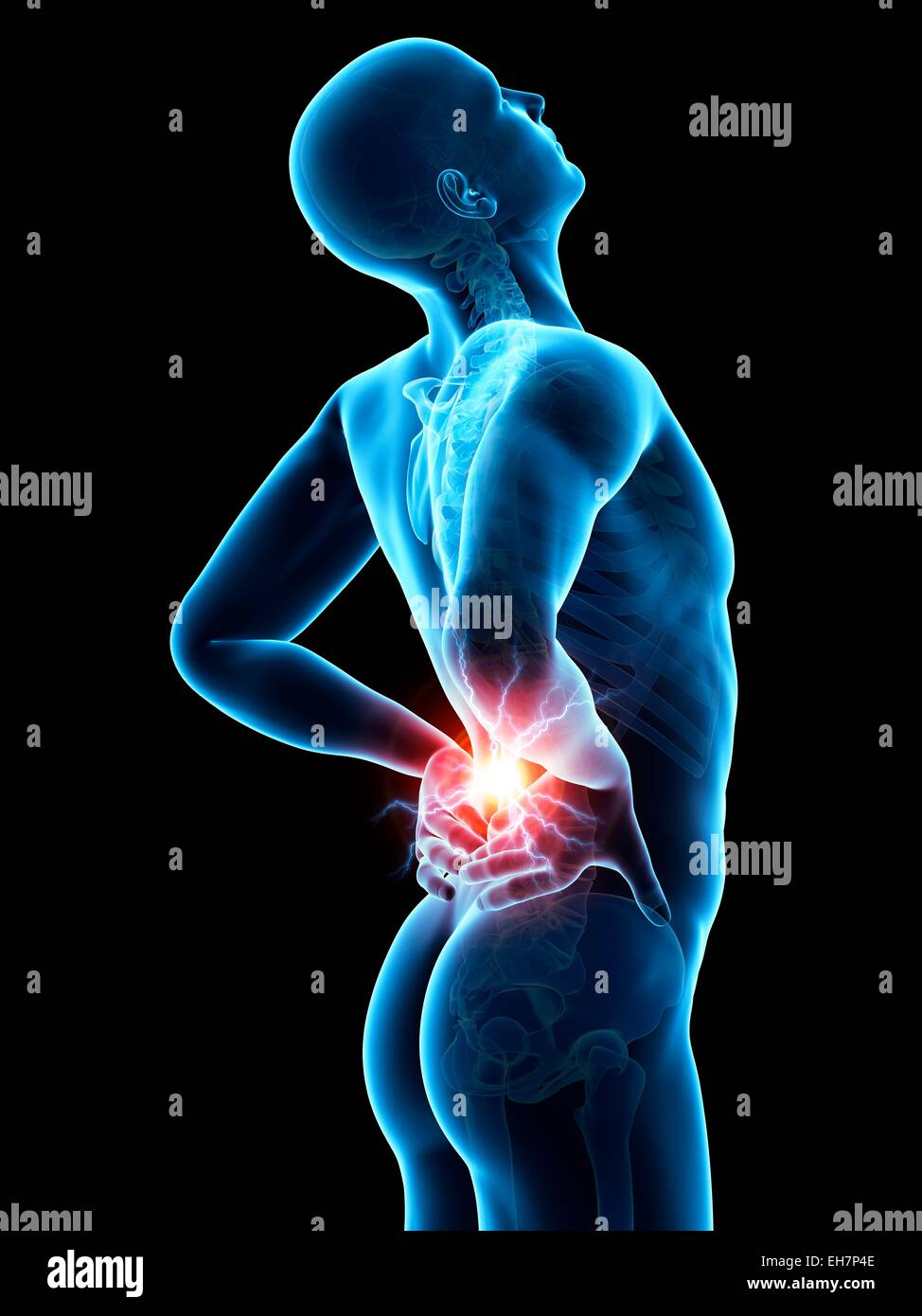 Human back pain, illustration Stock Photo - Alamy