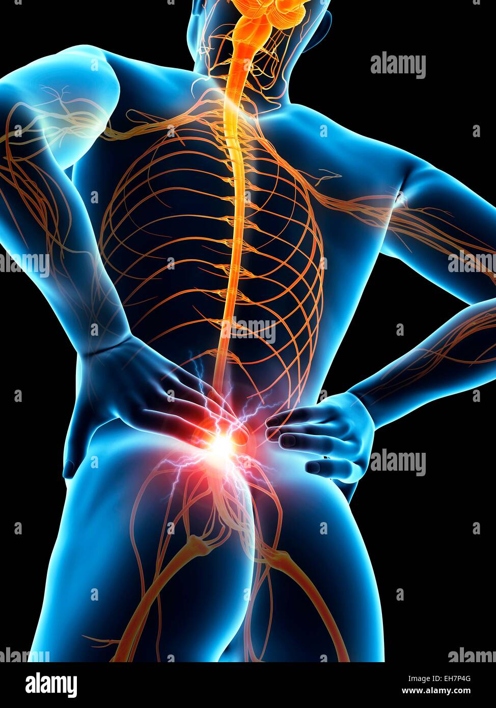 Human back pain, illustration Stock Photo - Alamy