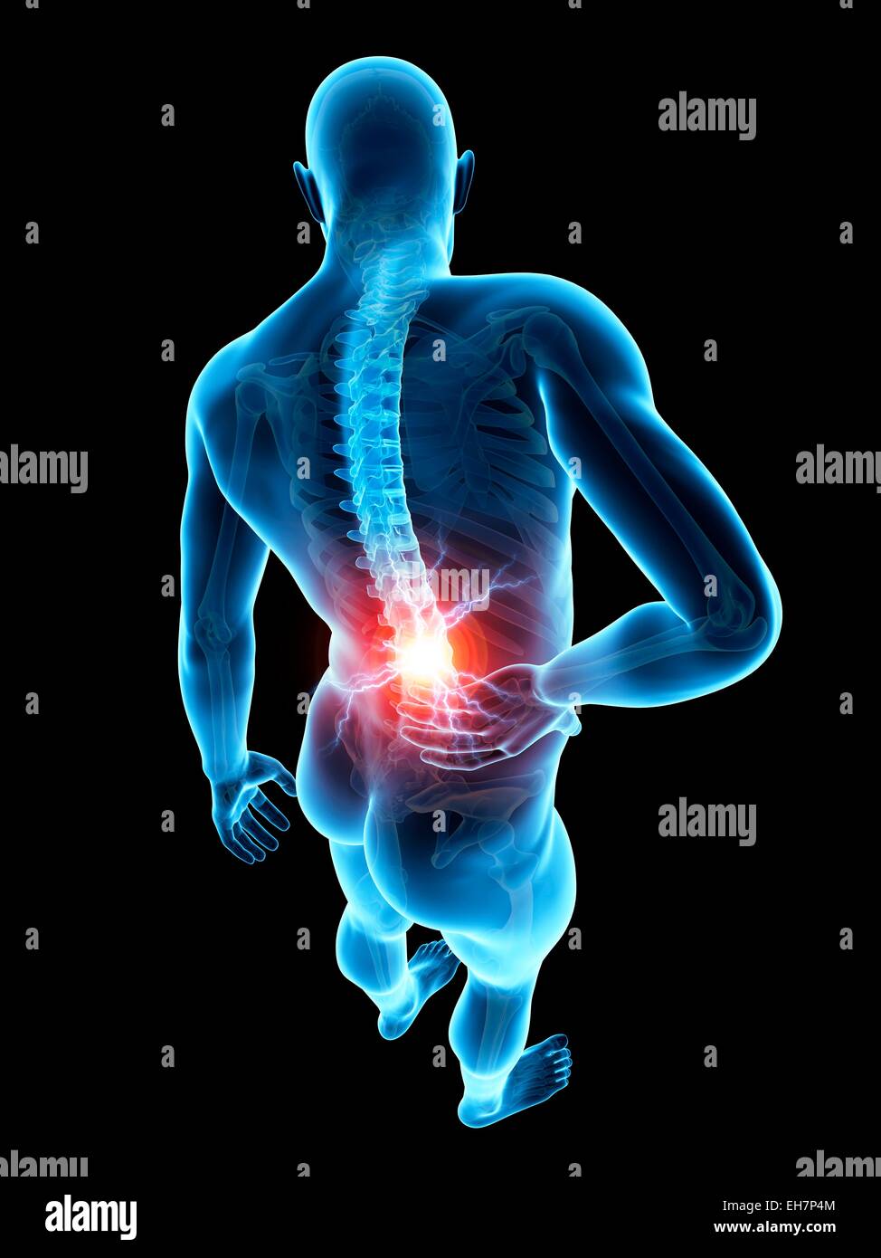 Human back pain, illustration Stock Photo - Alamy