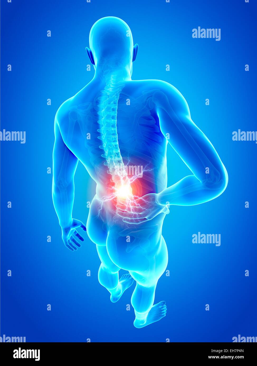 Human back pain, illustration Stock Photo - Alamy