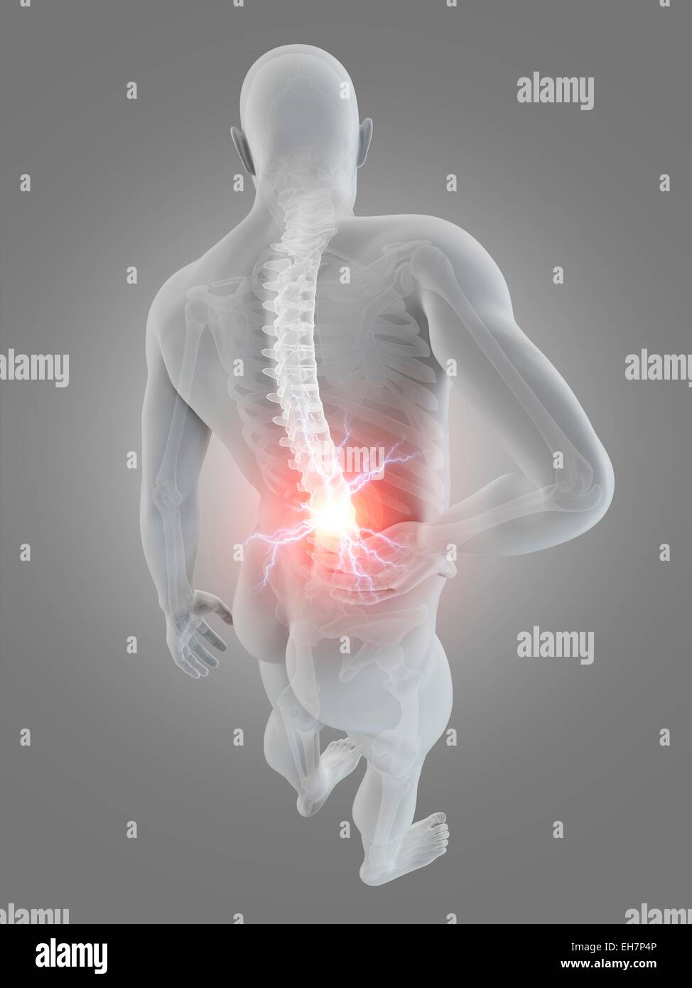 Human back pain, illustration Stock Photo - Alamy