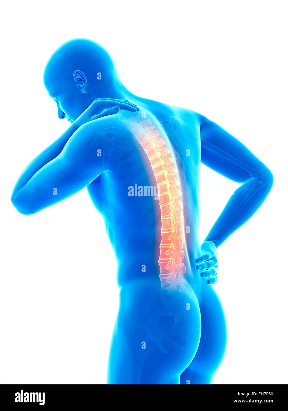 Human back pain, illustration Stock Photo - Alamy