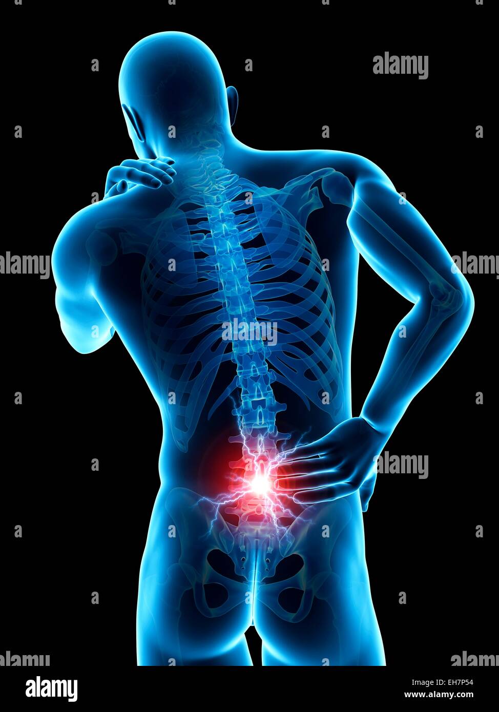 Human back pain, illustration Stock Photo - Alamy
