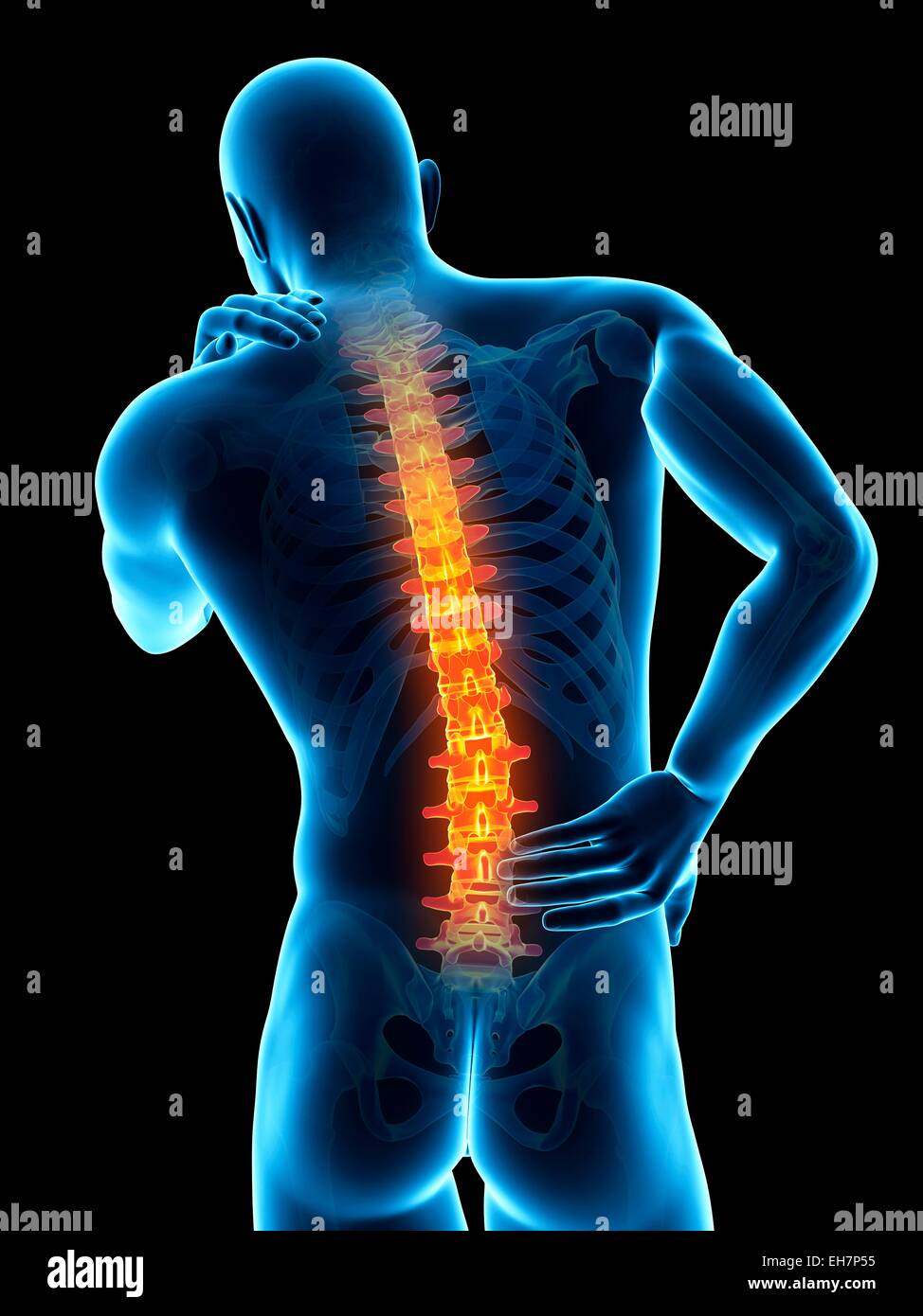 Human back pain, illustration Stock Photo - Alamy