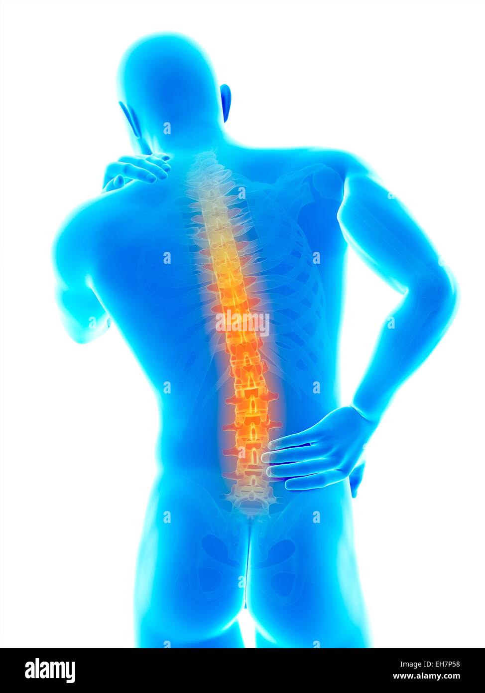 Human back pain, illustration Stock Photo - Alamy