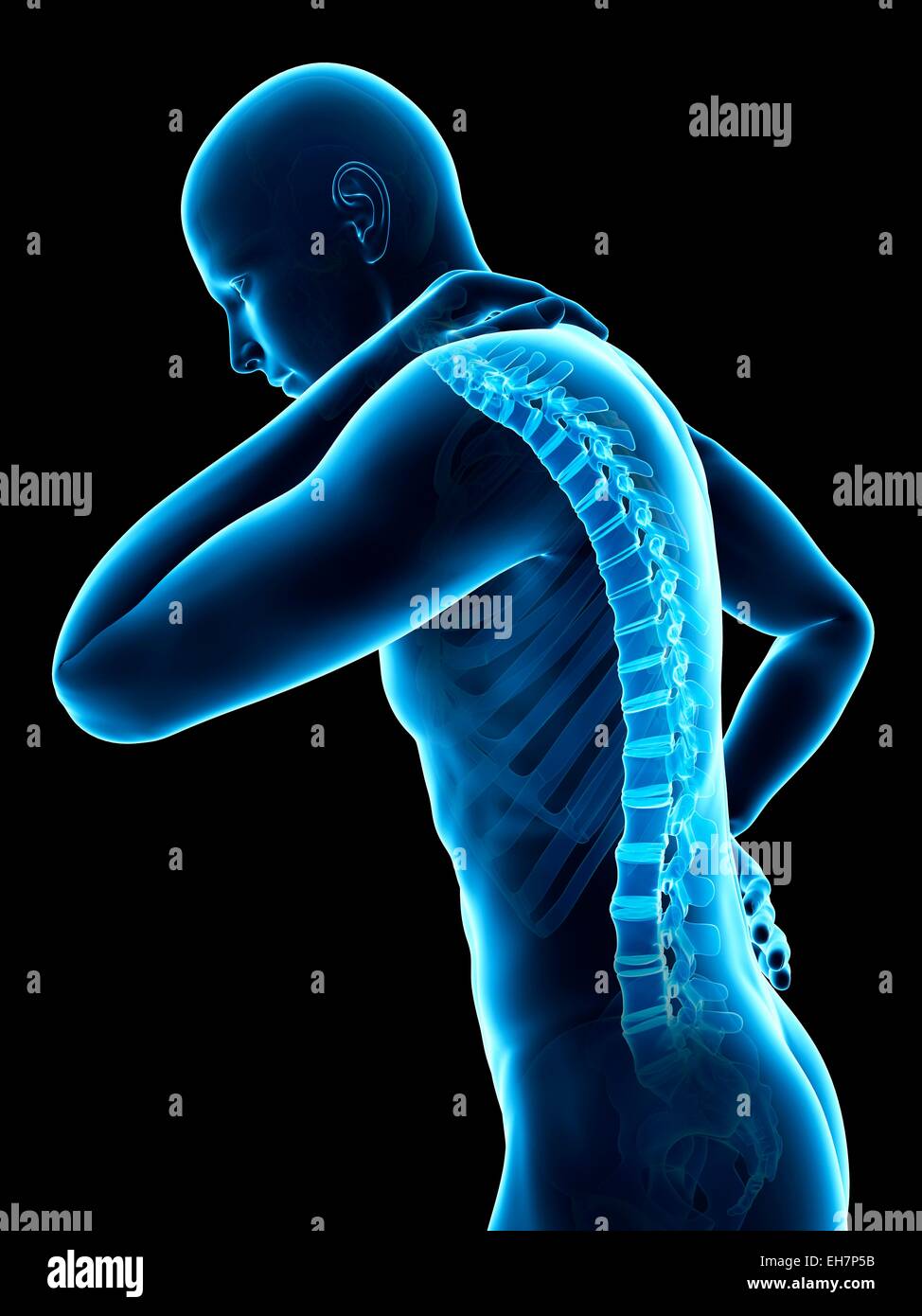 Human back pain, illustration Stock Photo - Alamy