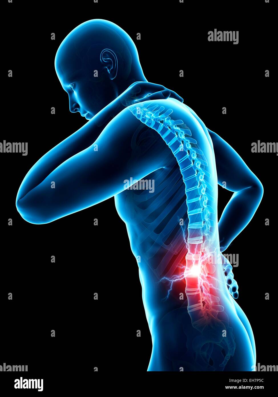 Human back pain, illustration Stock Photo - Alamy