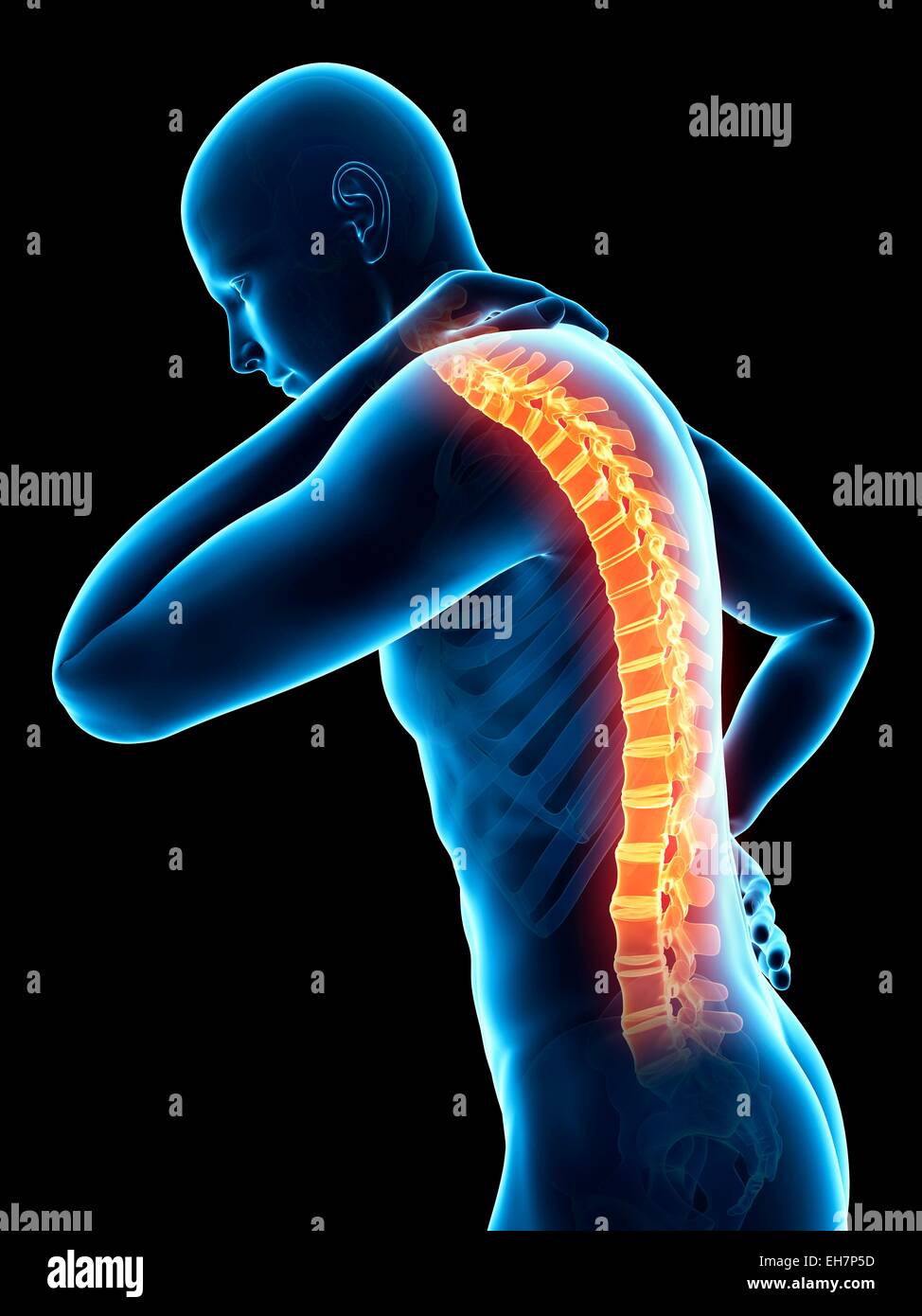 Human back pain, illustration Stock Photo - Alamy