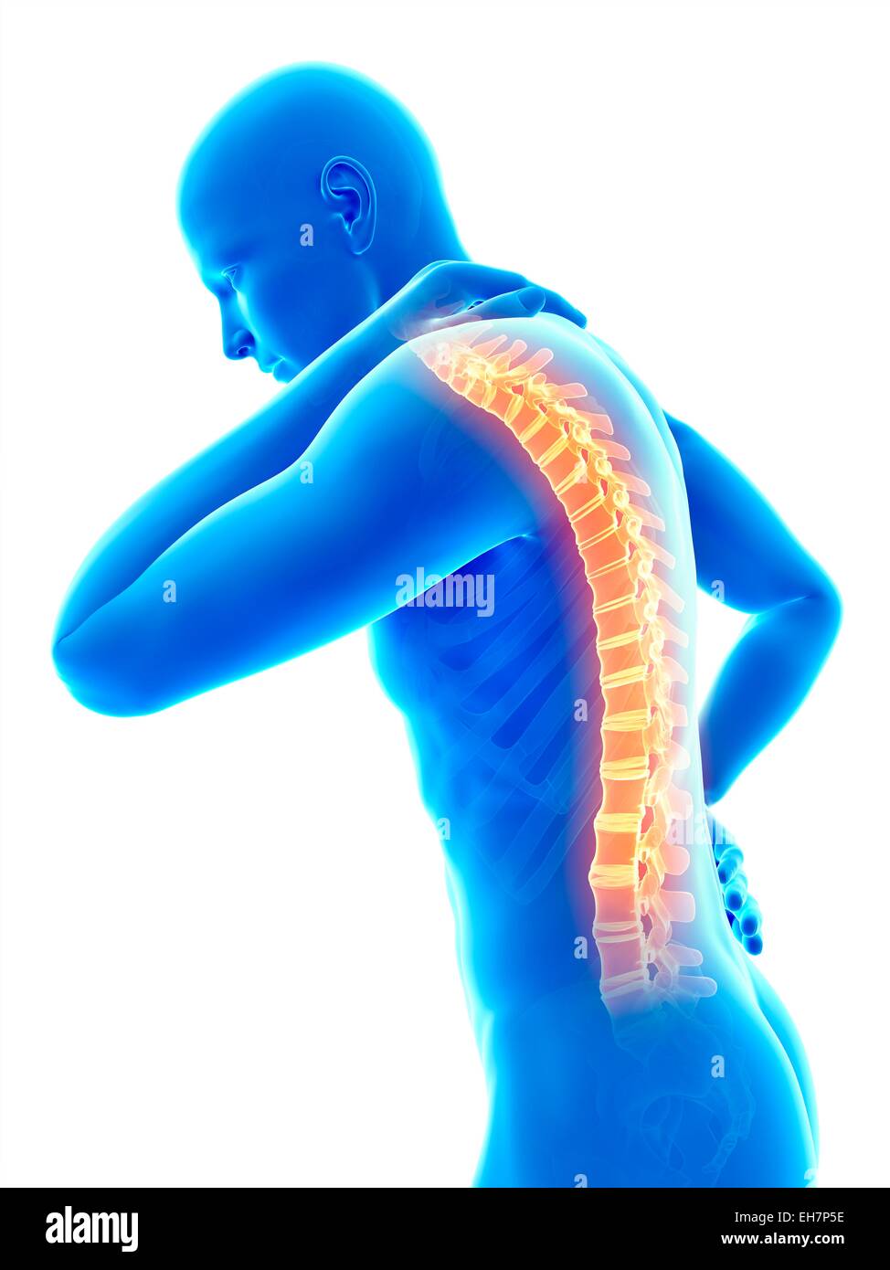 Human back pain, illustration Stock Photo - Alamy