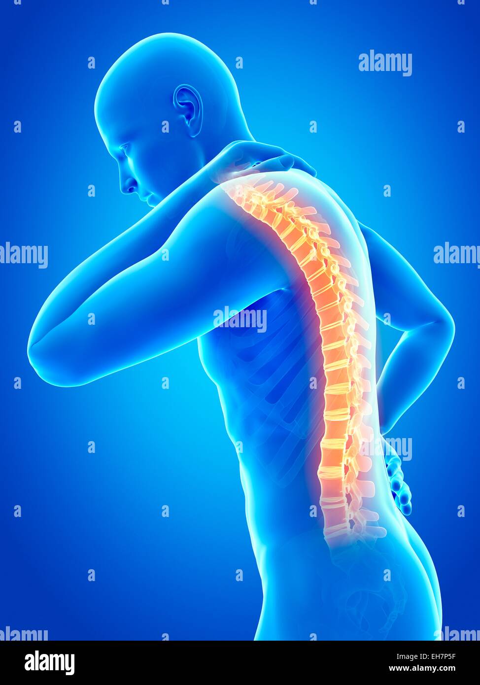 Human back pain, illustration Stock Photo - Alamy
