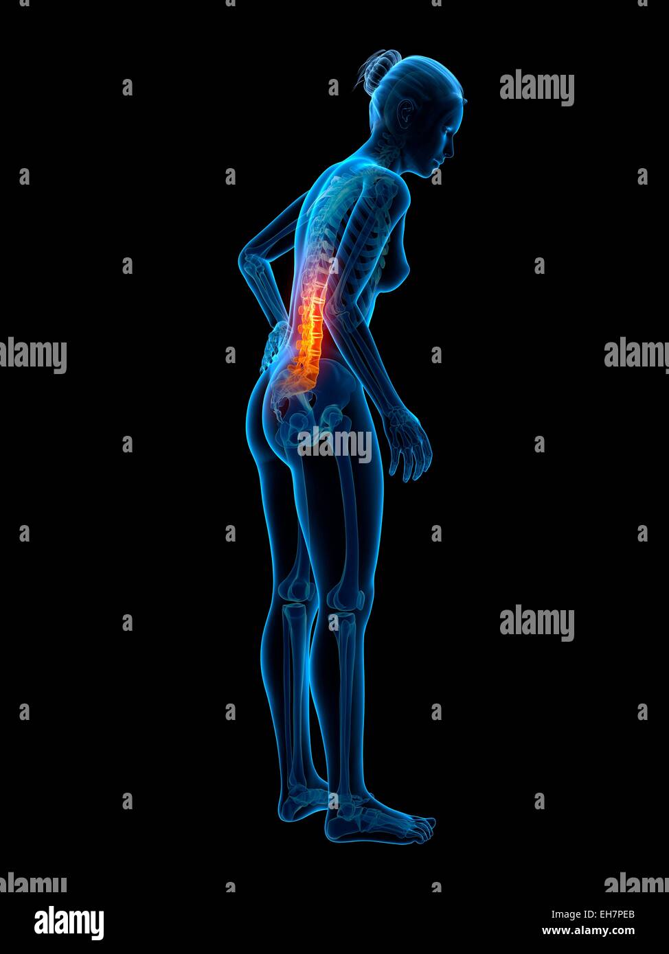 Human back pain, illustration Stock Photo - Alamy