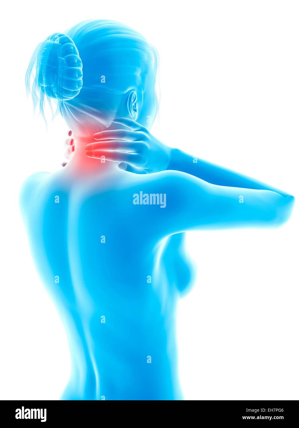 Human neck pain, illustration Stock Photo - Alamy