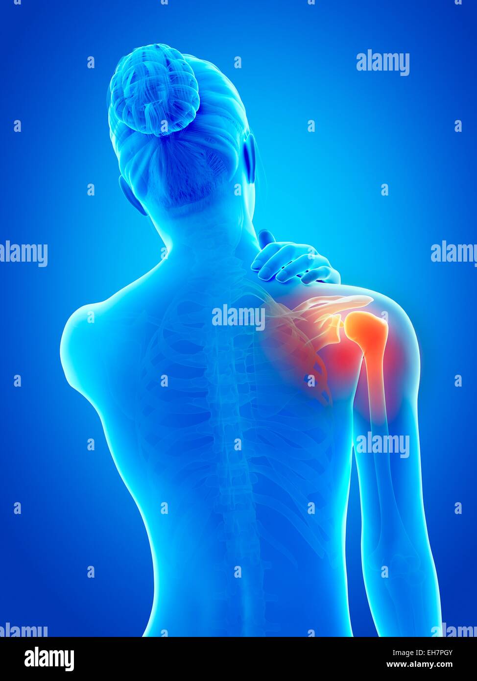 Human shoulder pain, illustration Stock Photo - Alamy