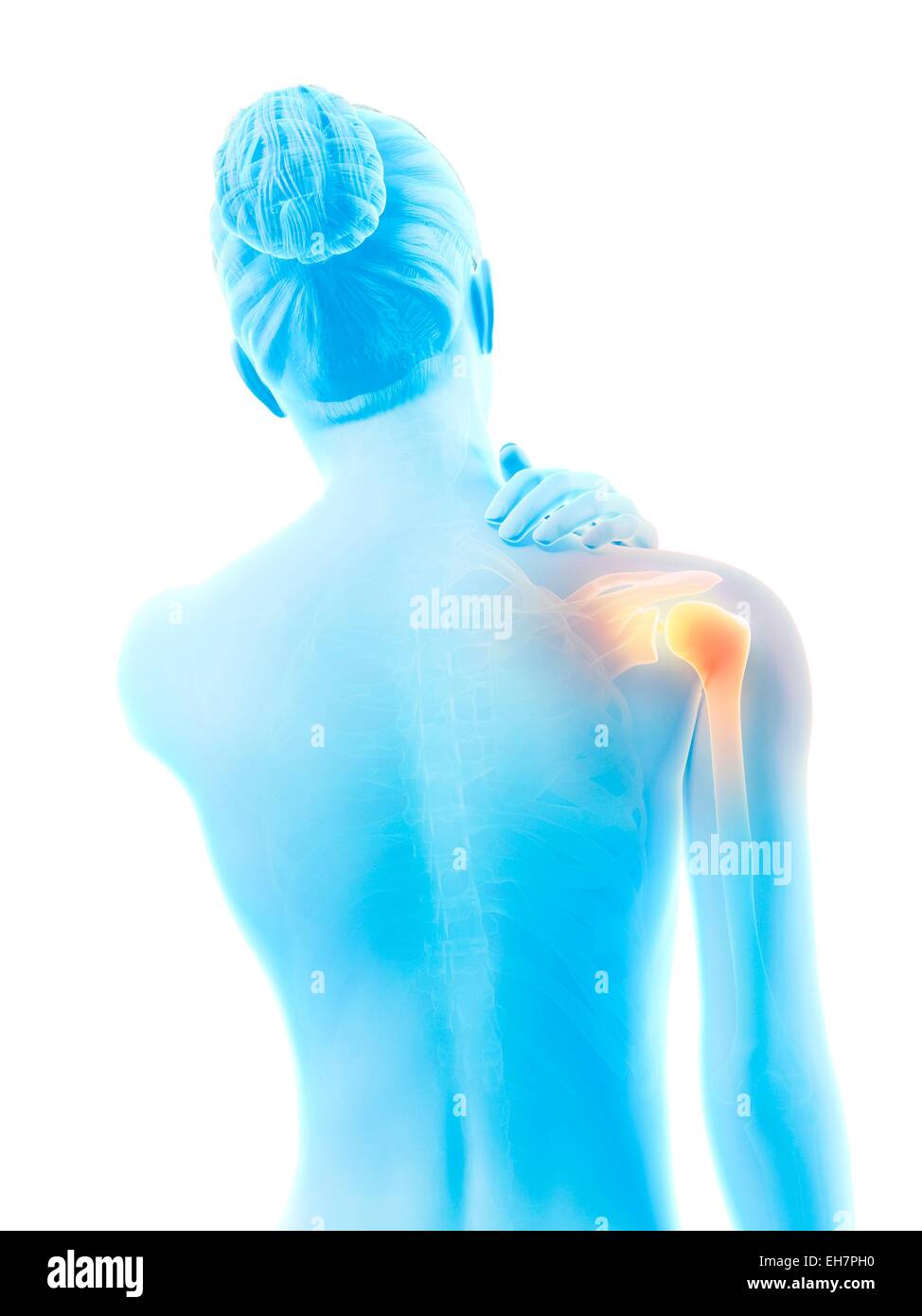 Human shoulder pain, illustration Stock Photo - Alamy