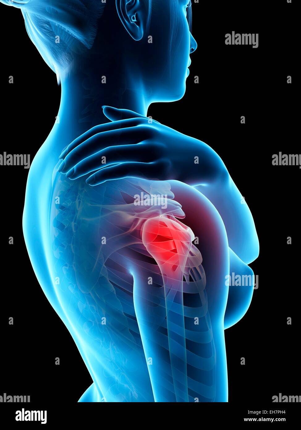 Human shoulder pain, illustration Stock Photo - Alamy