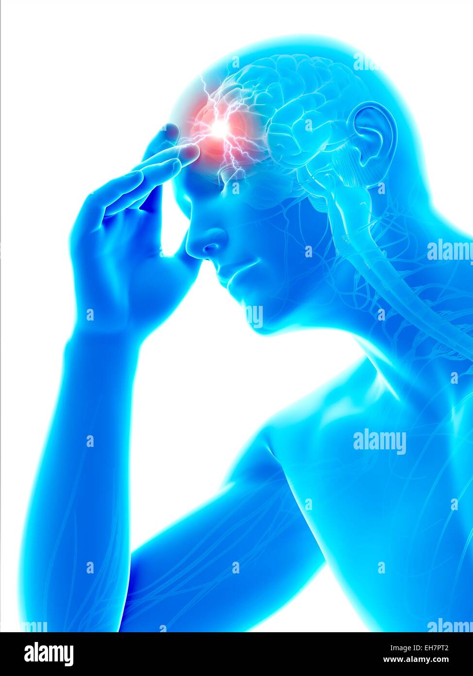 Human headache, illustration Stock Photo - Alamy
