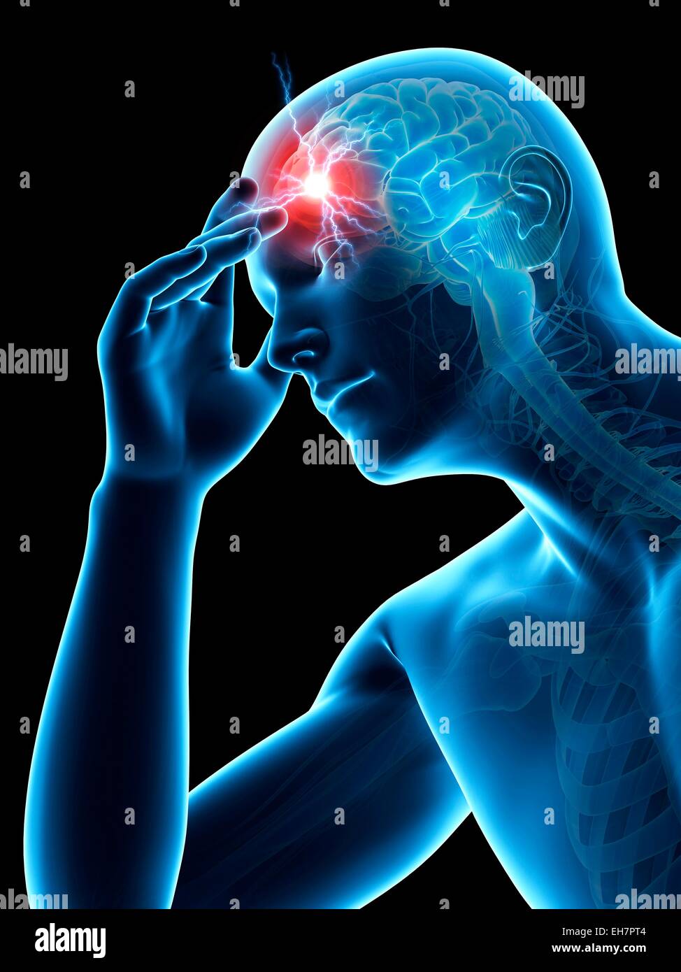 Human headache, illustration Stock Photo - Alamy