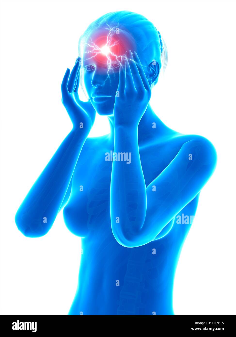 Human headache, illustration Stock Photo - Alamy