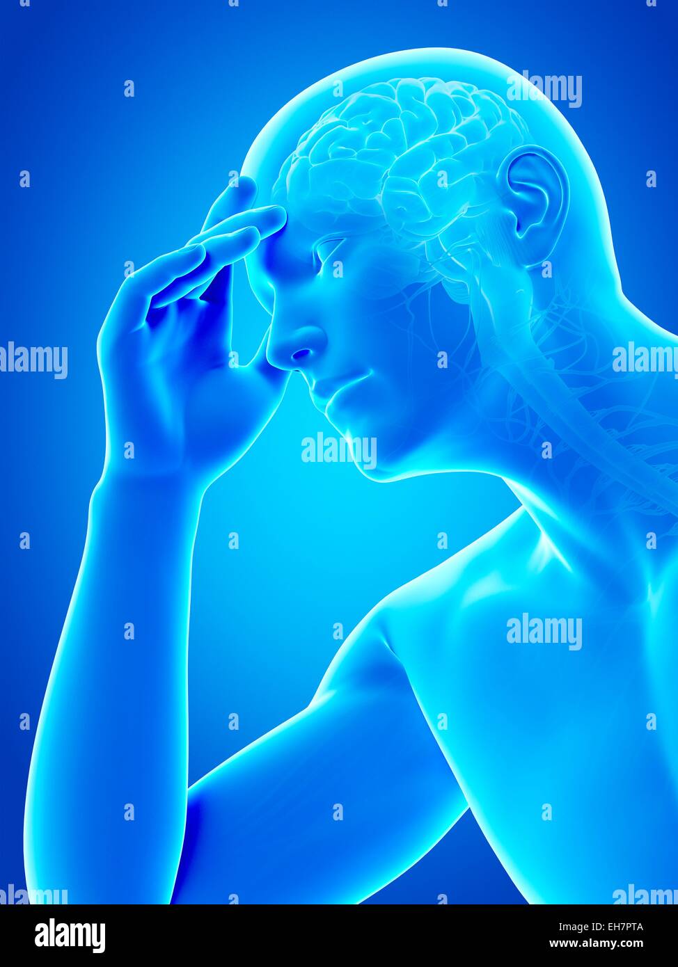 Human headache, illustration Stock Photo - Alamy