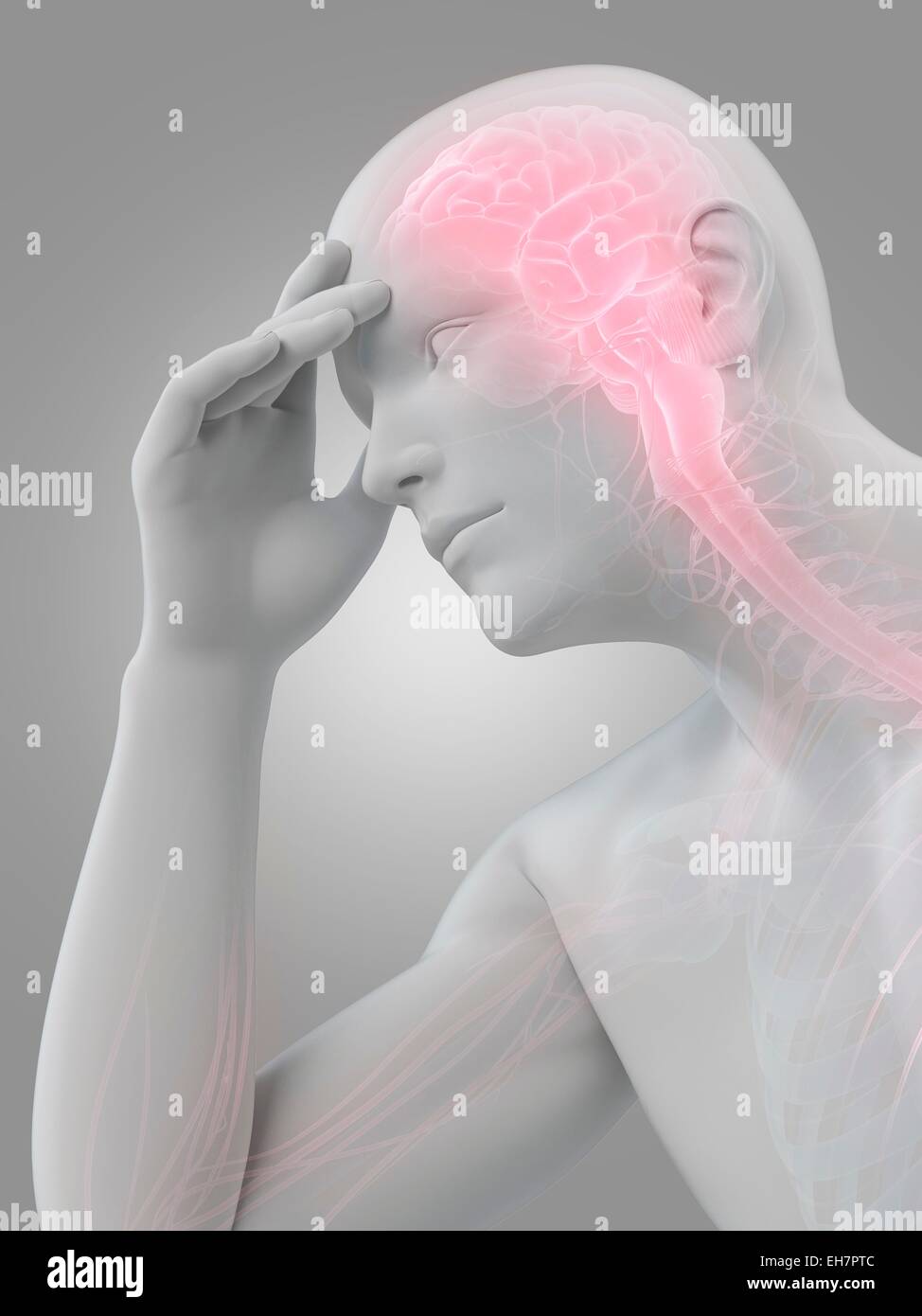 Human headache, illustration Stock Photo - Alamy