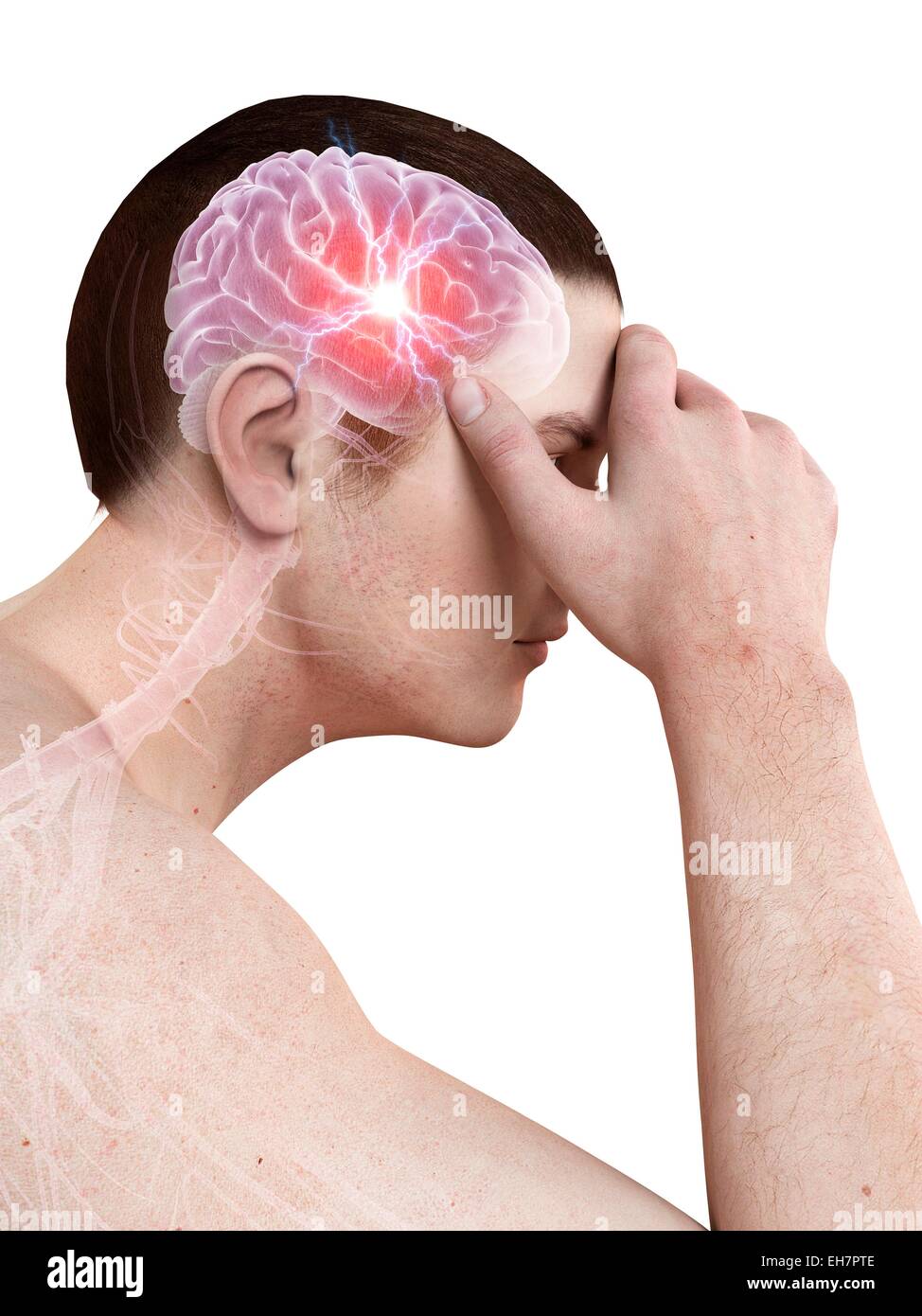 Human headache, illustration Stock Photo - Alamy