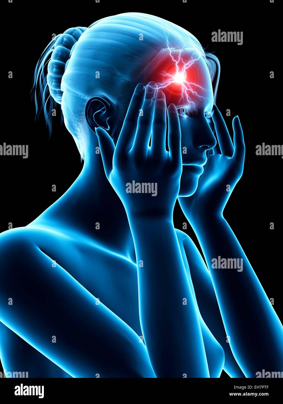 Human headache, illustration Stock Photo - Alamy