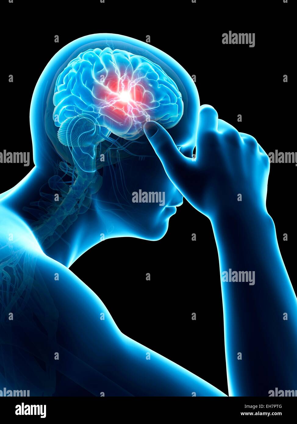 Human headache, illustration Stock Photo - Alamy