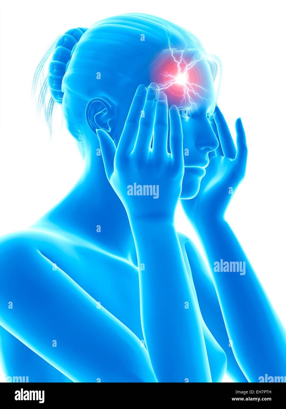Human headache, illustration Stock Photo - Alamy