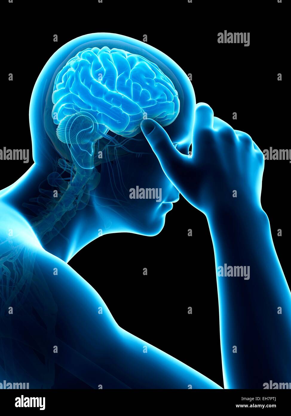 Human headache, illustration Stock Photo - Alamy