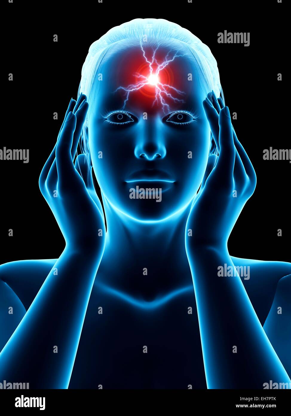 Human headache, illustration Stock Photo - Alamy